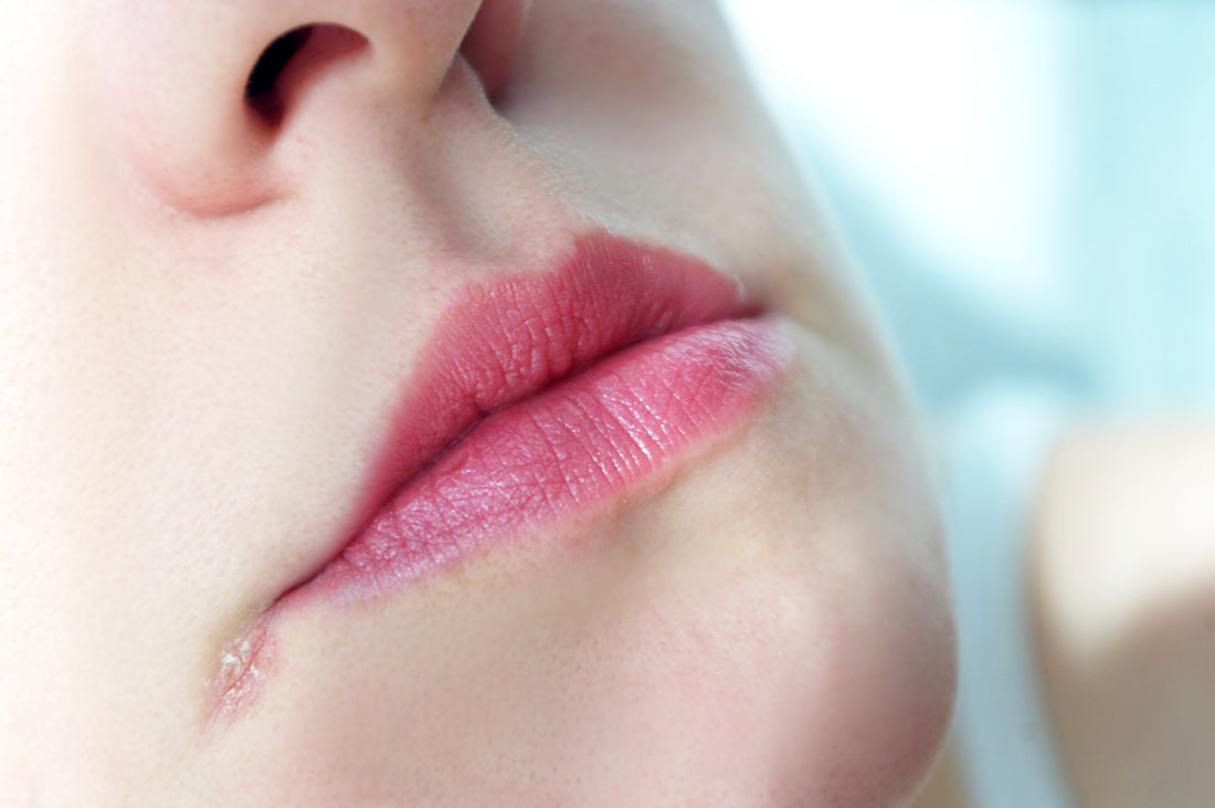 Tips on How to Treat Angular Cheilitis – Chapstick SBC